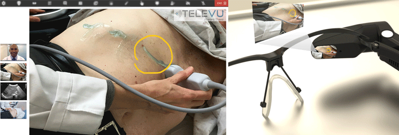 TeleVU – TelePresence AR + AI